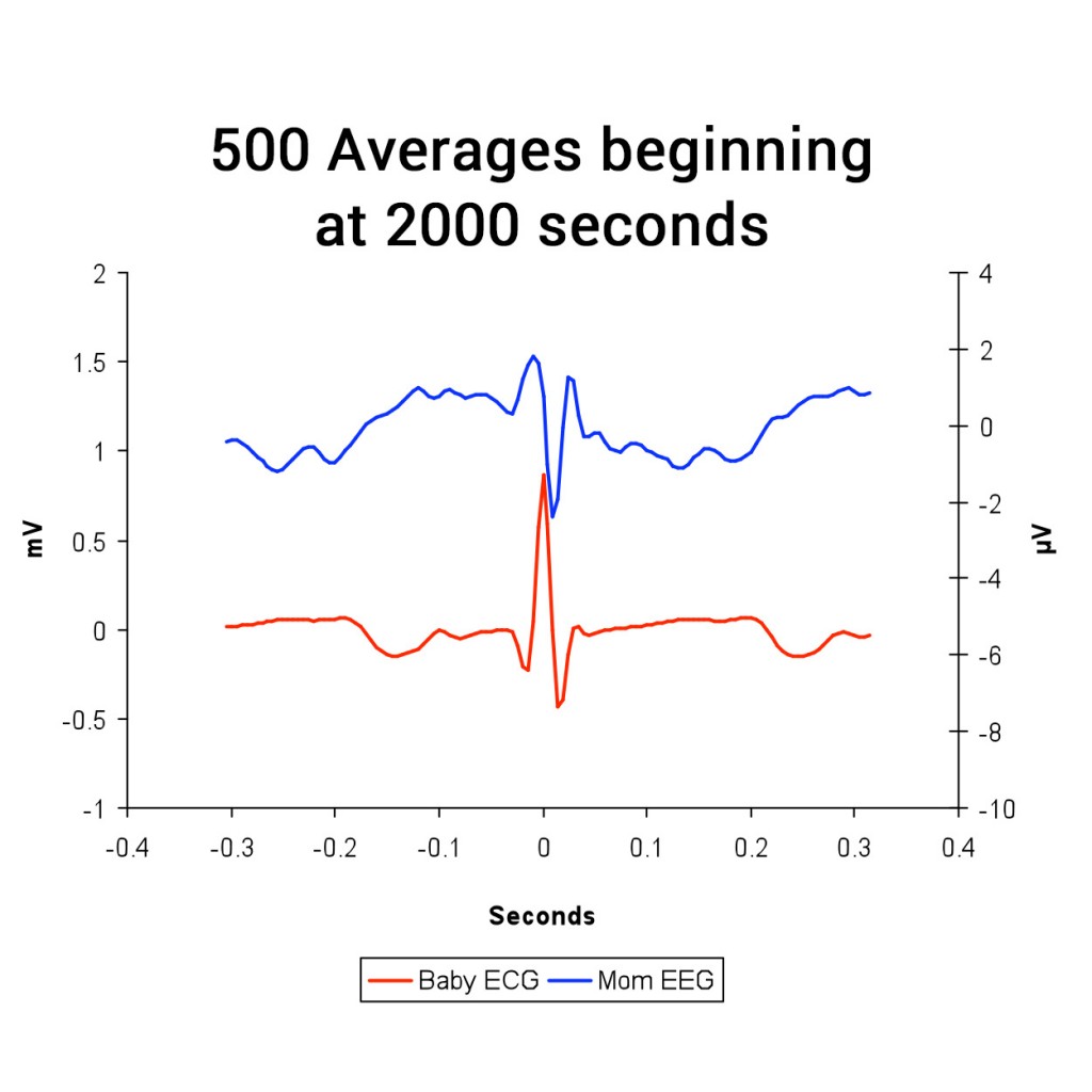 The Energetic Heart Is Unfolding | HeartMath Institute